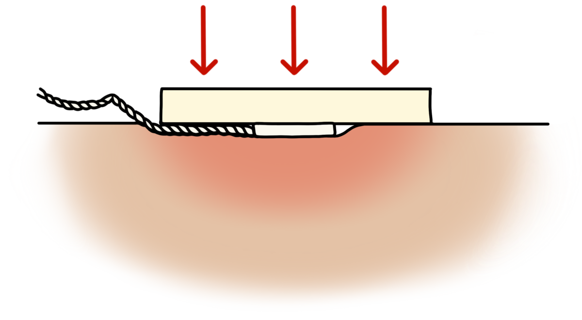 Starboard Medical’s Skin Temperature Sensors
