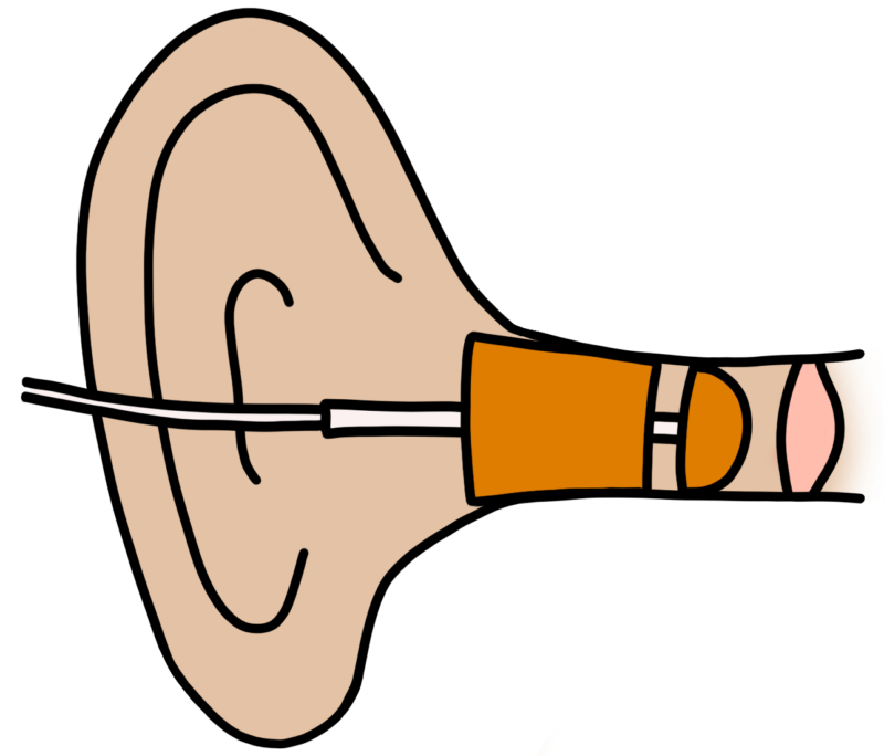 Tympanic probe Temperature Sensors - Starboard Medical